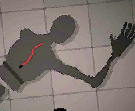 Endoparasitic 2 - Play Online Endoparasitic 2 on Horror Games